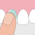 CurodontTM Protect – vVARDIS Professional US