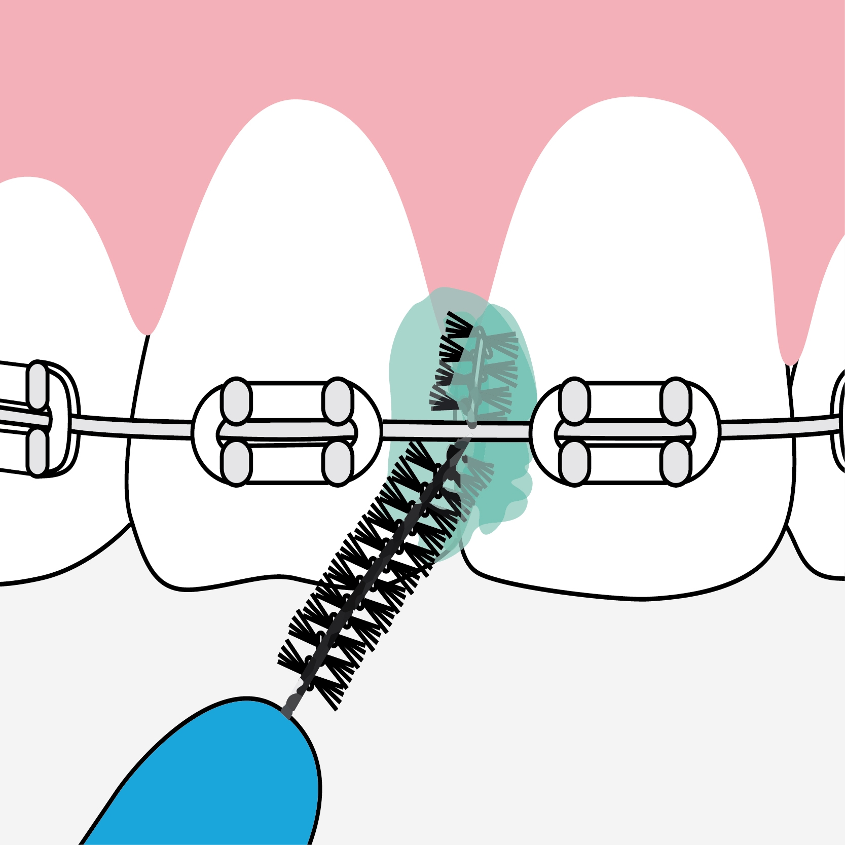 CurodontTM Protect – vVARDIS Professional US